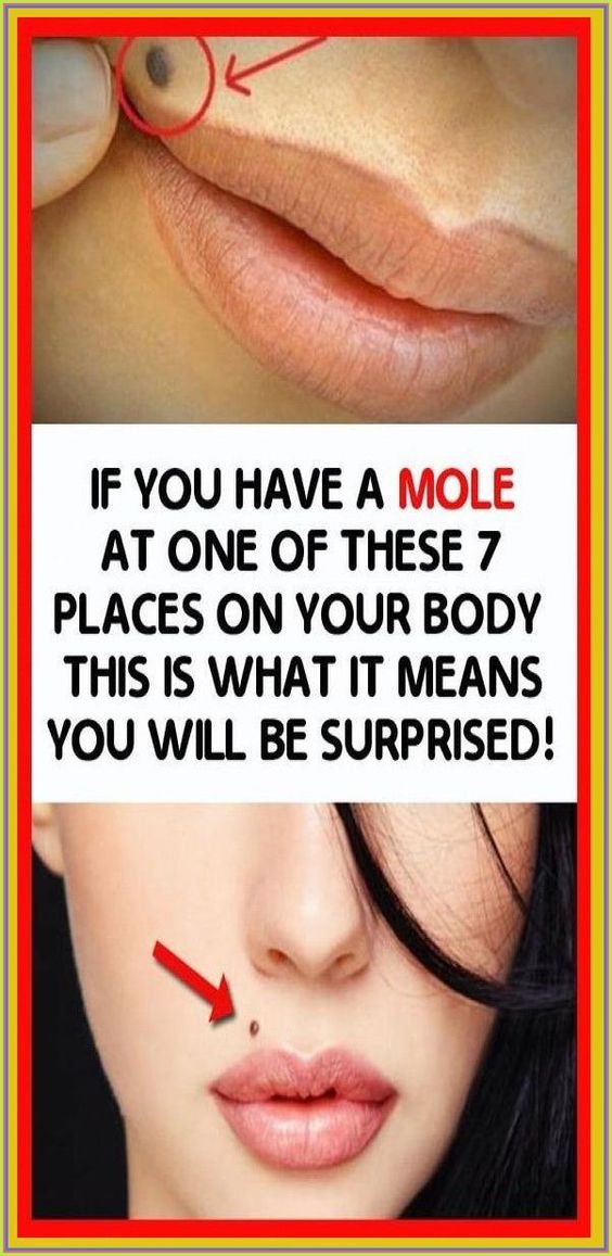 IF YOU HAVE A MOLE AT ONE OF THESE 7 PLACES ON YOUR BODY THIS IS WHAT ...