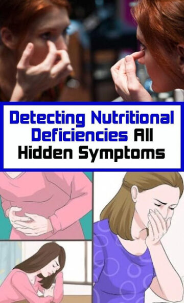 6 Most Common Nutrient Deficiencies in Women – Natural Health Care
